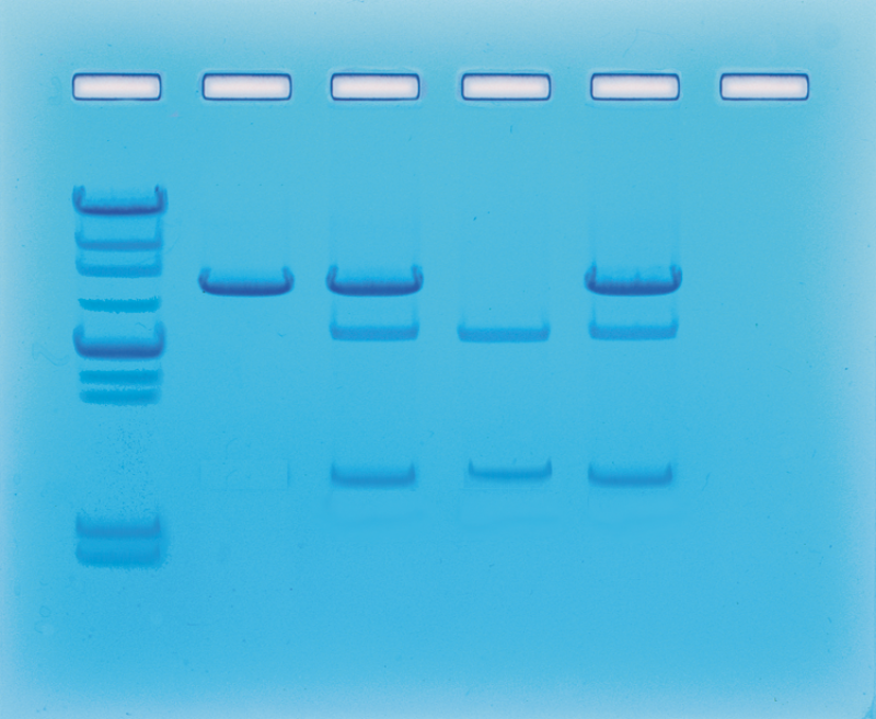 Cancer Gene Detection » BioTek