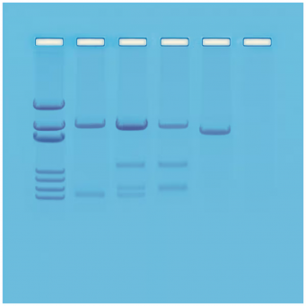 Cancer Gene Detection » BioTek