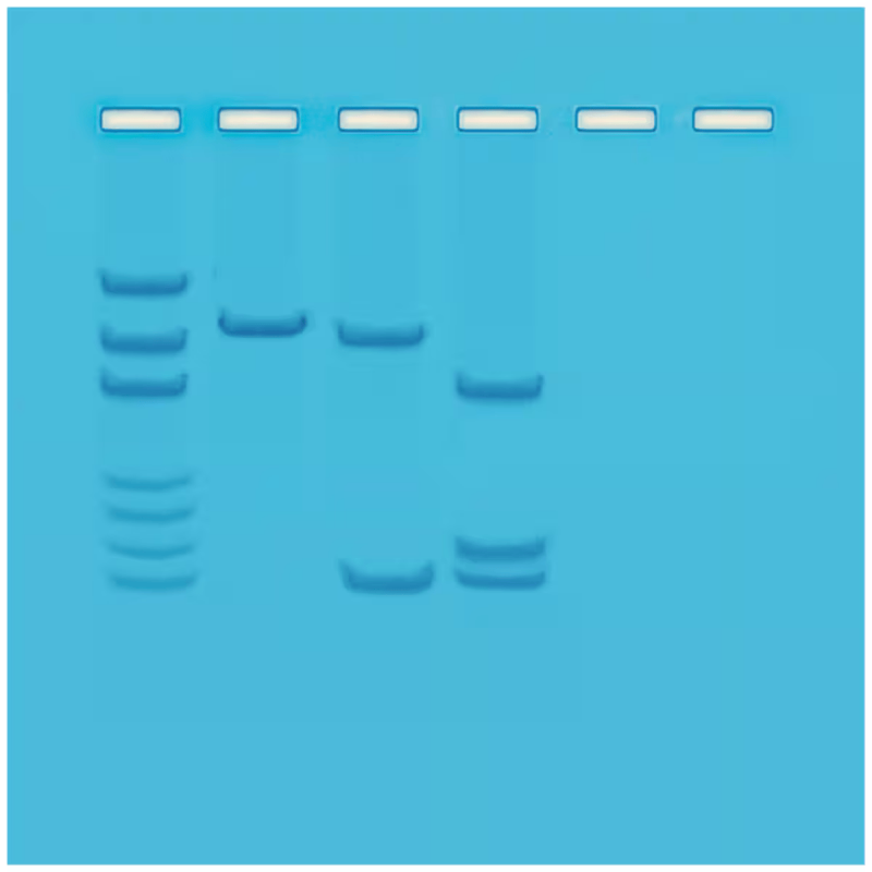 Mapping of Restriction Sites on Plasmid DNA » BioTek